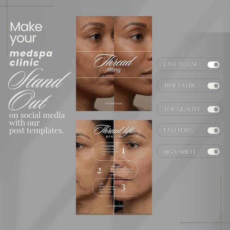 PDO Thread Lift Before & After Instagram Posts: Medspa Social Media ...