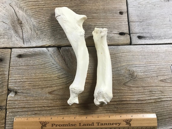 Real Radius Bone
