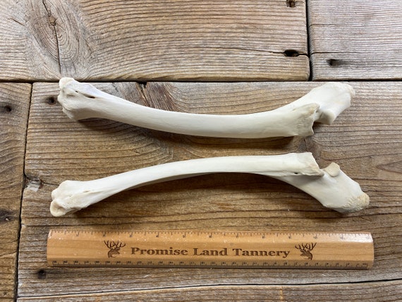 Real Leg Bones