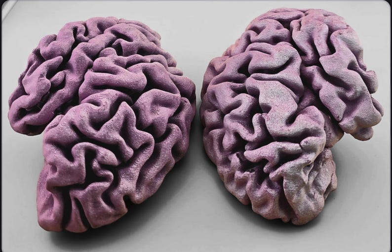 Custom MRI Brain Model Personalized Anatomical Gift for Doctor, Medical ...