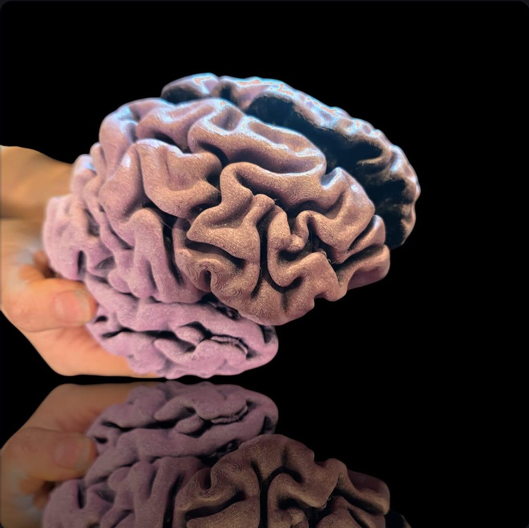 Custom MRI Brain Model Personalized Anatomical Gift for Doctor, Medical ...