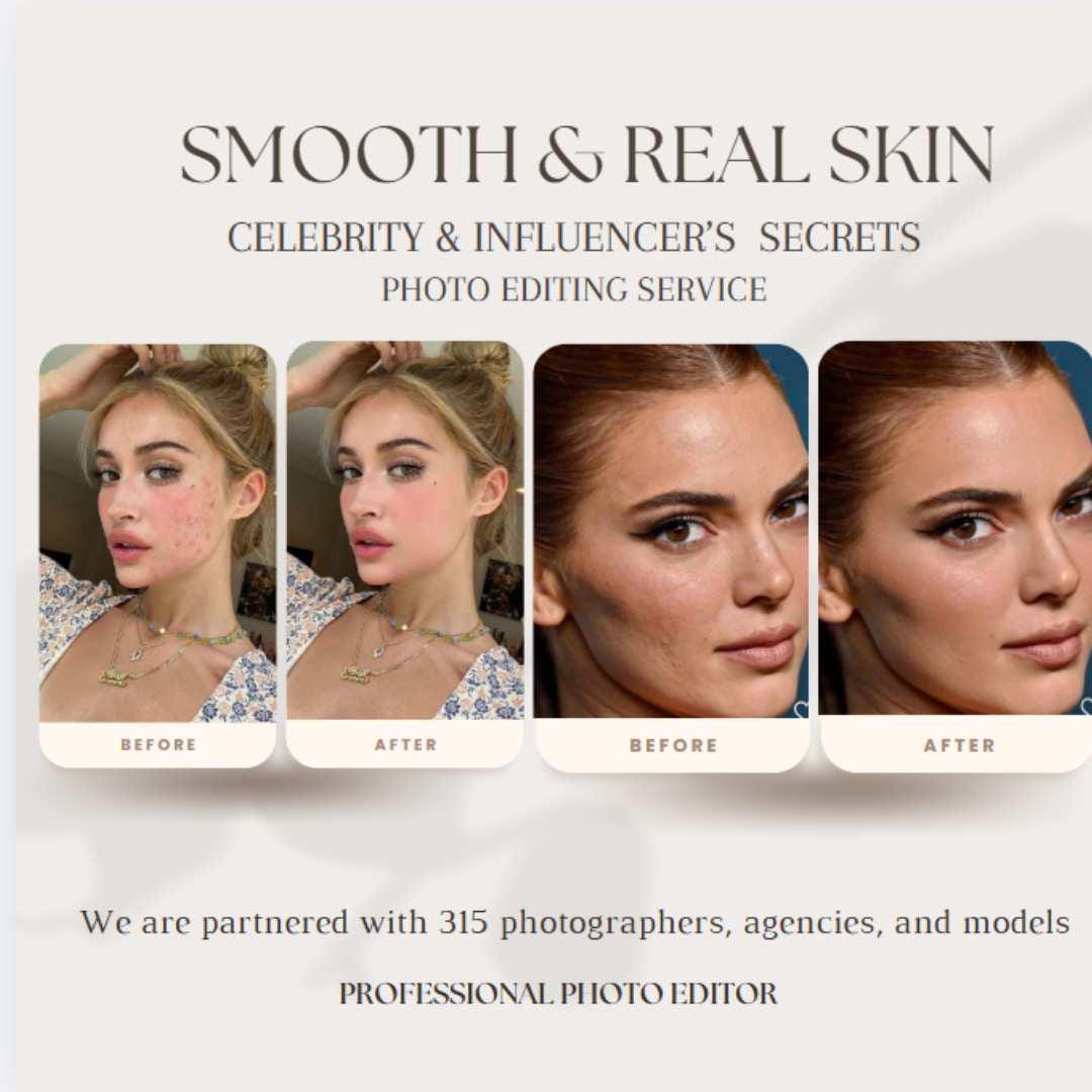 PHOTOSHOP ENHANCEMENT - ACNE Smooth Skin Retouch Photoshop, Digital ...