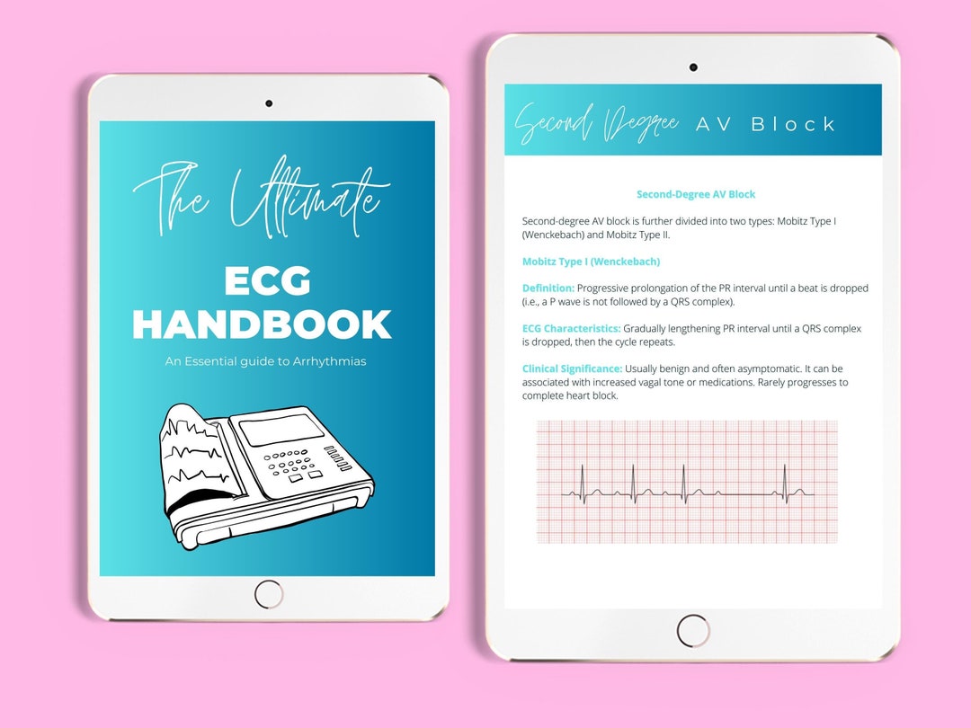 ECG Interpretation & Rhythms ECG Study Guide Digital Download PDF ...