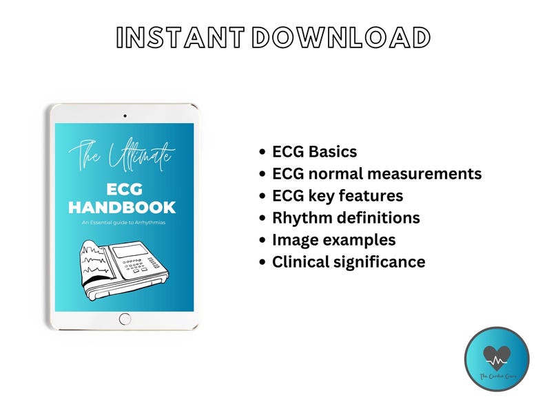 ECG Rhythms & Arrhythmias | EKG Dysarrhythmias | Sinus Rhythms | AV ...