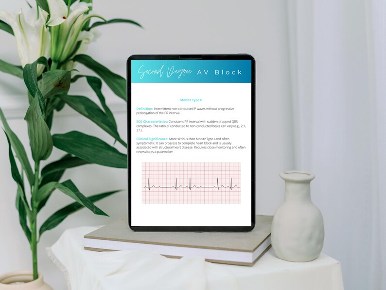 ECG Interpretation & Rhythms ECG Study Guide Digital Download PDF ...