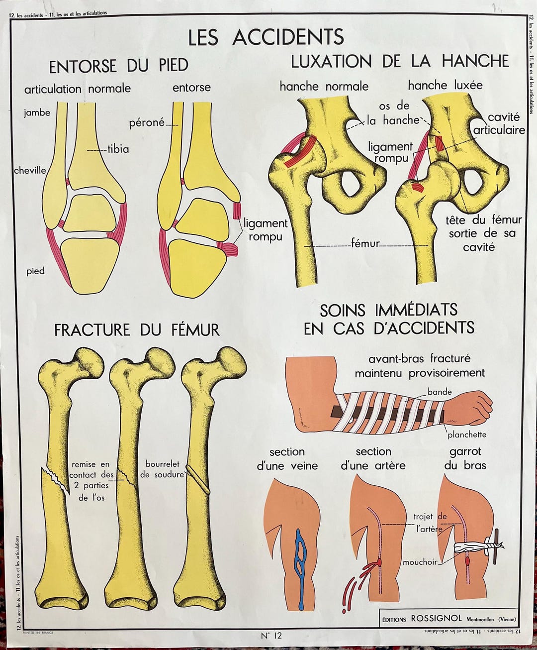 Vintage French Educational Chart, Accidents, Health and Wellness, Bones ...