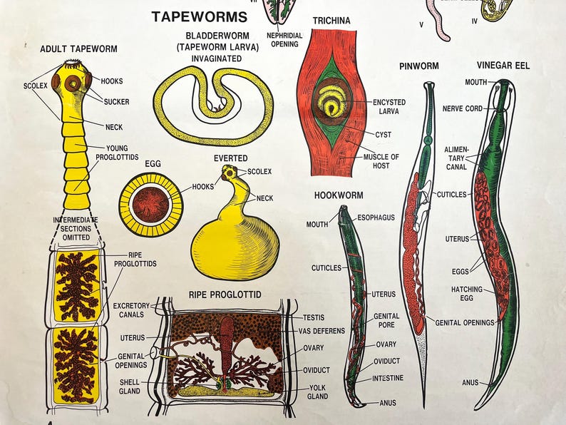 Platyhelminthes Chart, Nematoda, Original 1960s Science and Education ...