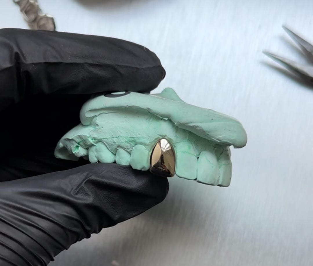 Dental Gold Custom Grillz Made by Qualified Dental Technician | Premium ...