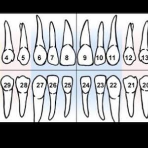 Custom 2 Teeth Vampire Fang Gold or Silver Grillz With Fangs Free ...