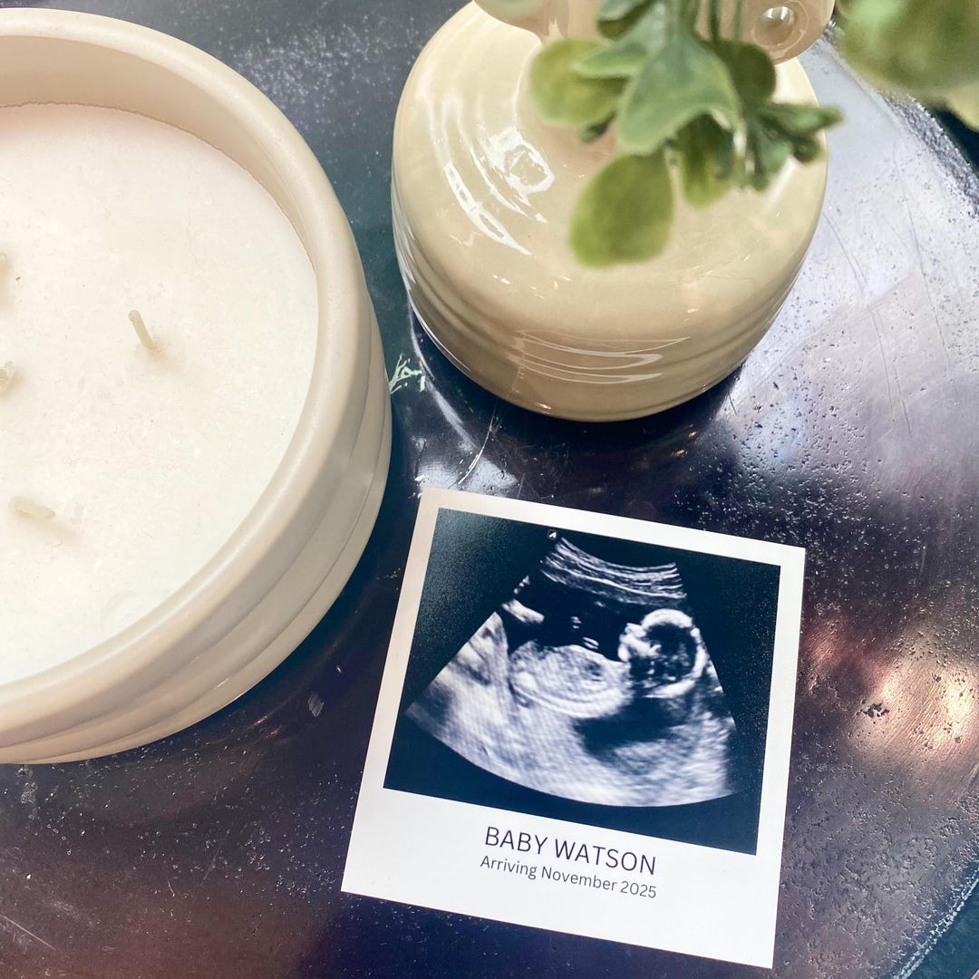 Pregnancy Announcement Keepsake| Baby Ultrasound Magnet| Baby's Due ...