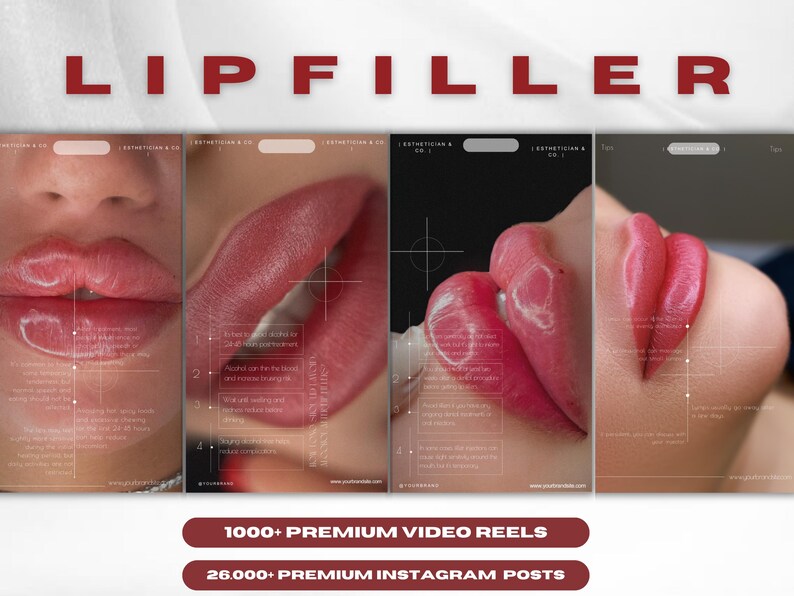Lipfiller Instagram Templates | Aesthetic Medspa Templates | Nurse ...
