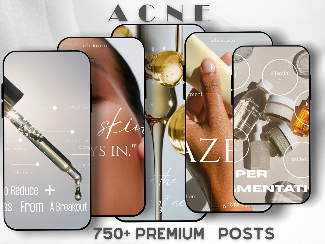 Acne Specialist, Acne Instagram Template, Esthetician Instagram Content ...