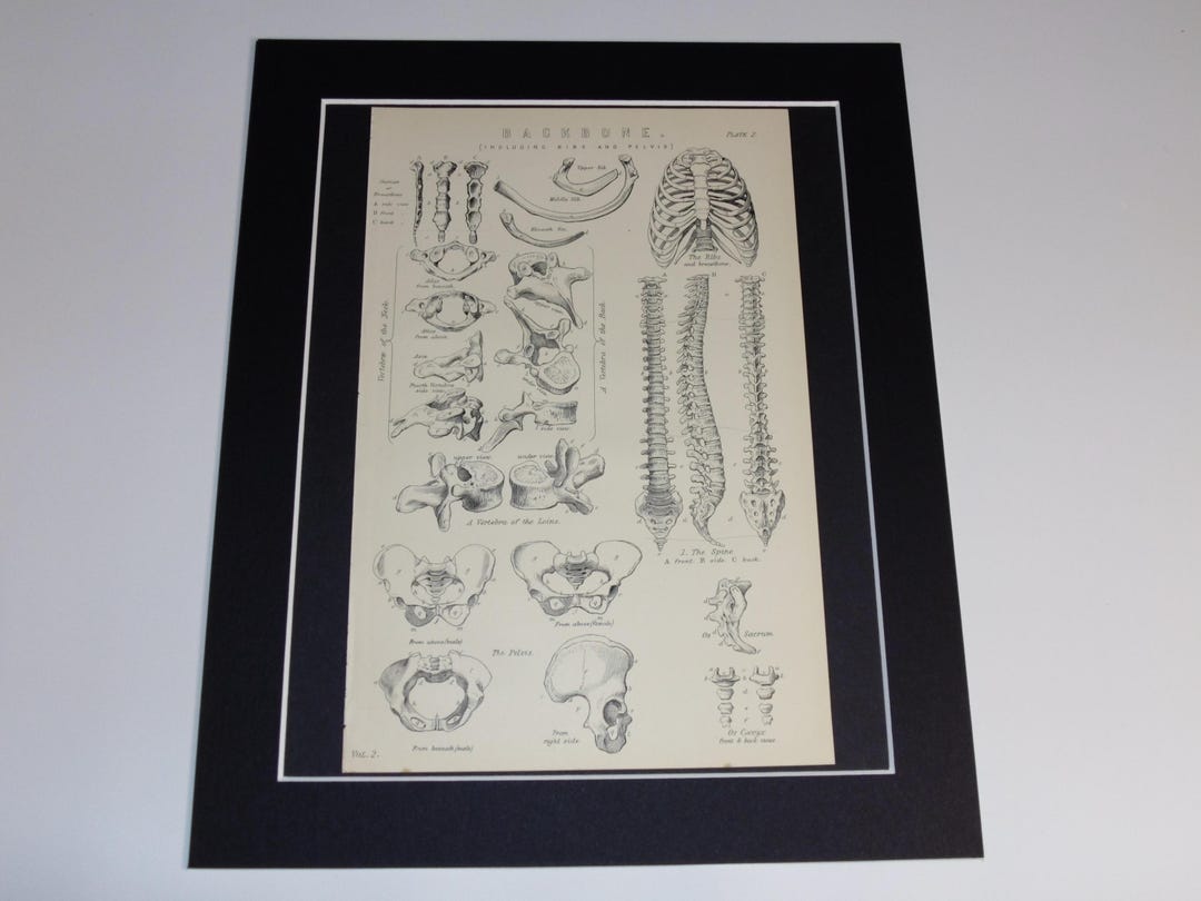 Backbone Human Anatomy, Inc. Ribs and Pelvis Original Victorian Mounted ...