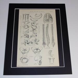 Backbone Human Anatomy, Inc. Ribs and Pelvis Original Victorian Mounted ...