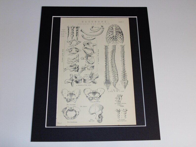 Backbone Human Anatomy, Inc. Ribs and Pelvis Original Victorian Mounted ...