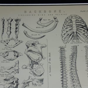 Backbone Human Anatomy, Inc. Ribs and Pelvis Original Victorian Mounted ...