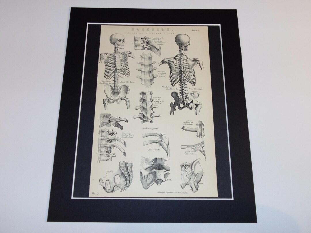 Backbone Human Anatomy 2 Original Victorian Book Plate, 10x12, Medical ...