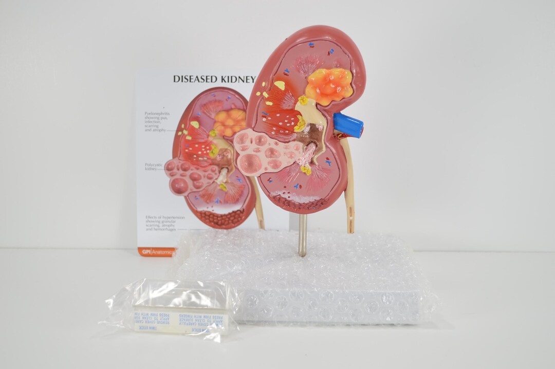 Vintage Anatomical Kidney Model Diseased Healthy Kidney Oddity Cabinet ...