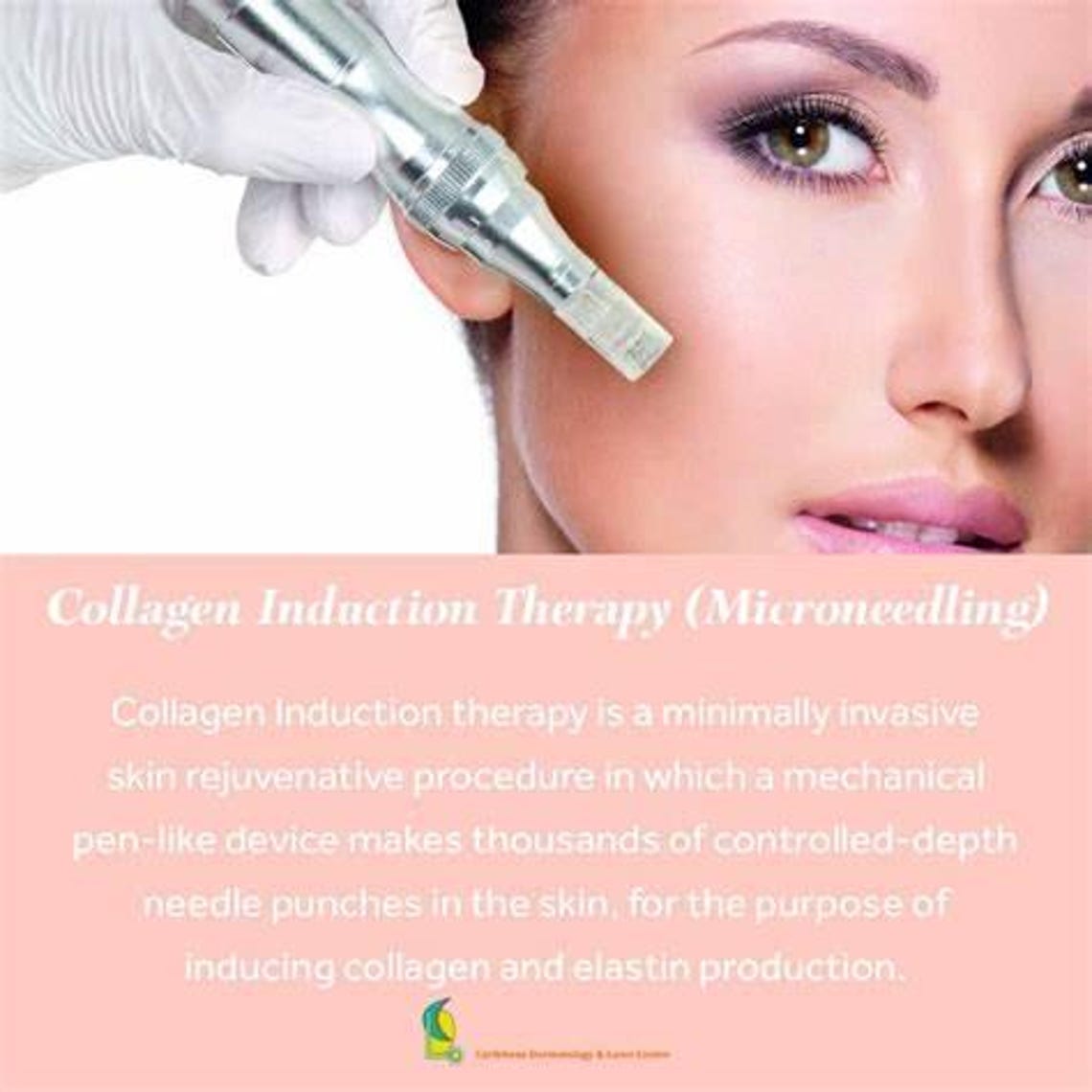 Collagen Induction Therapy - Micro Needling Training Manual - Etsy