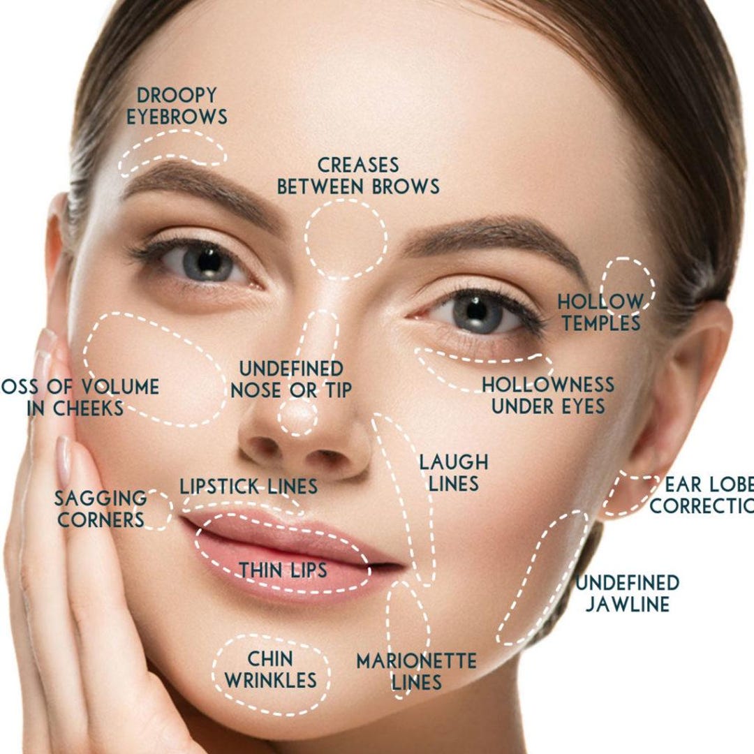 Foundation Dermal Filler Training Manual - Etsy