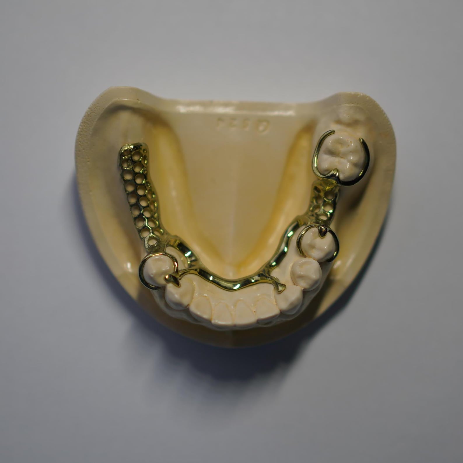 Removable Bracket and Porcelain Bridge (can Be Customized) Model for ...