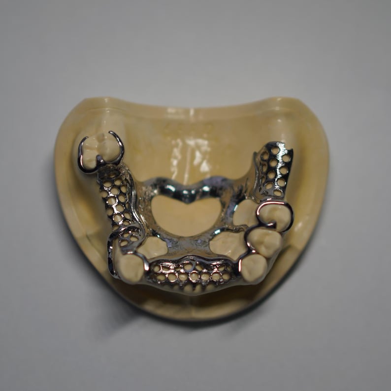 Removable Bracket and Porcelain Bridge (can Be Customized) Model for ...
