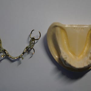 Removable Bracket and Porcelain Bridge (can Be Customized) Model for ...