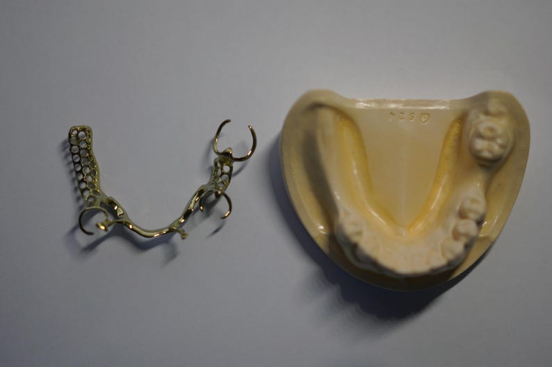 Removable Bracket and Porcelain Bridge (can Be Customized) Model for ...