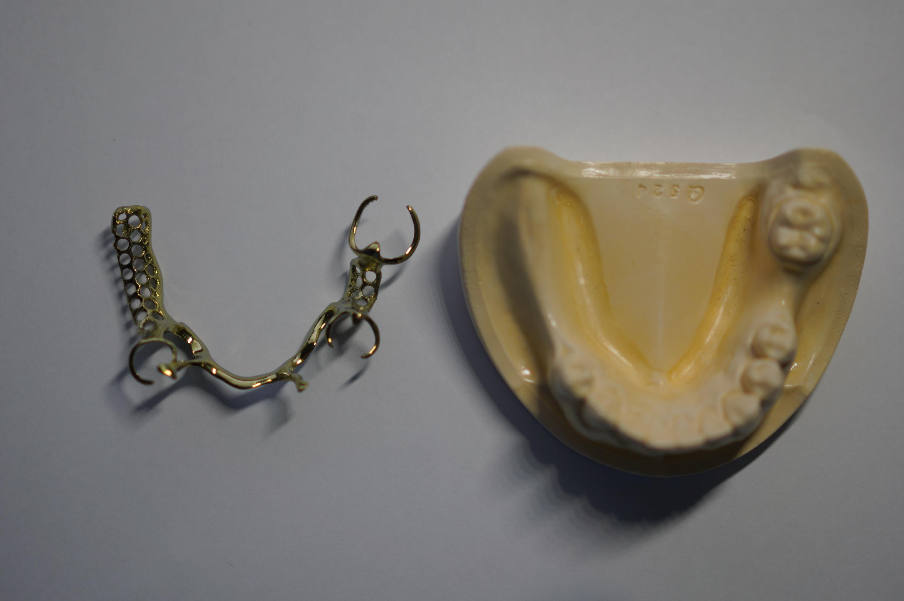 Removable Bracket and Porcelain Bridge (can Be Customized) Model for ...