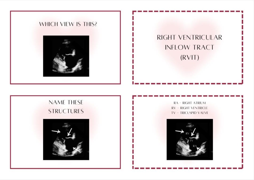 Echo Anatomy Flashcards Real Life Protocol Views/valves/walls/chambers ...