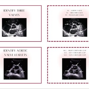 Echo Anatomy Flashcards, Real Life Protocol Views (digital File) - Etsy