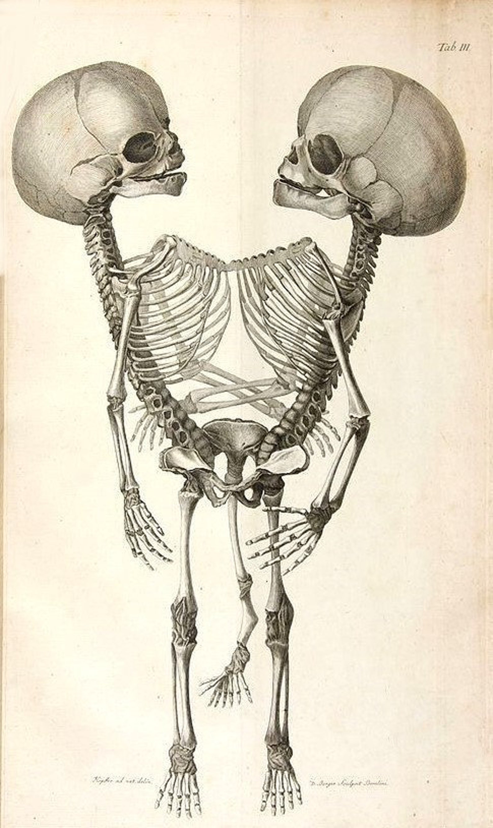 Conjoined Twins Vintage Image Note Card Halloween Graduation - Etsy