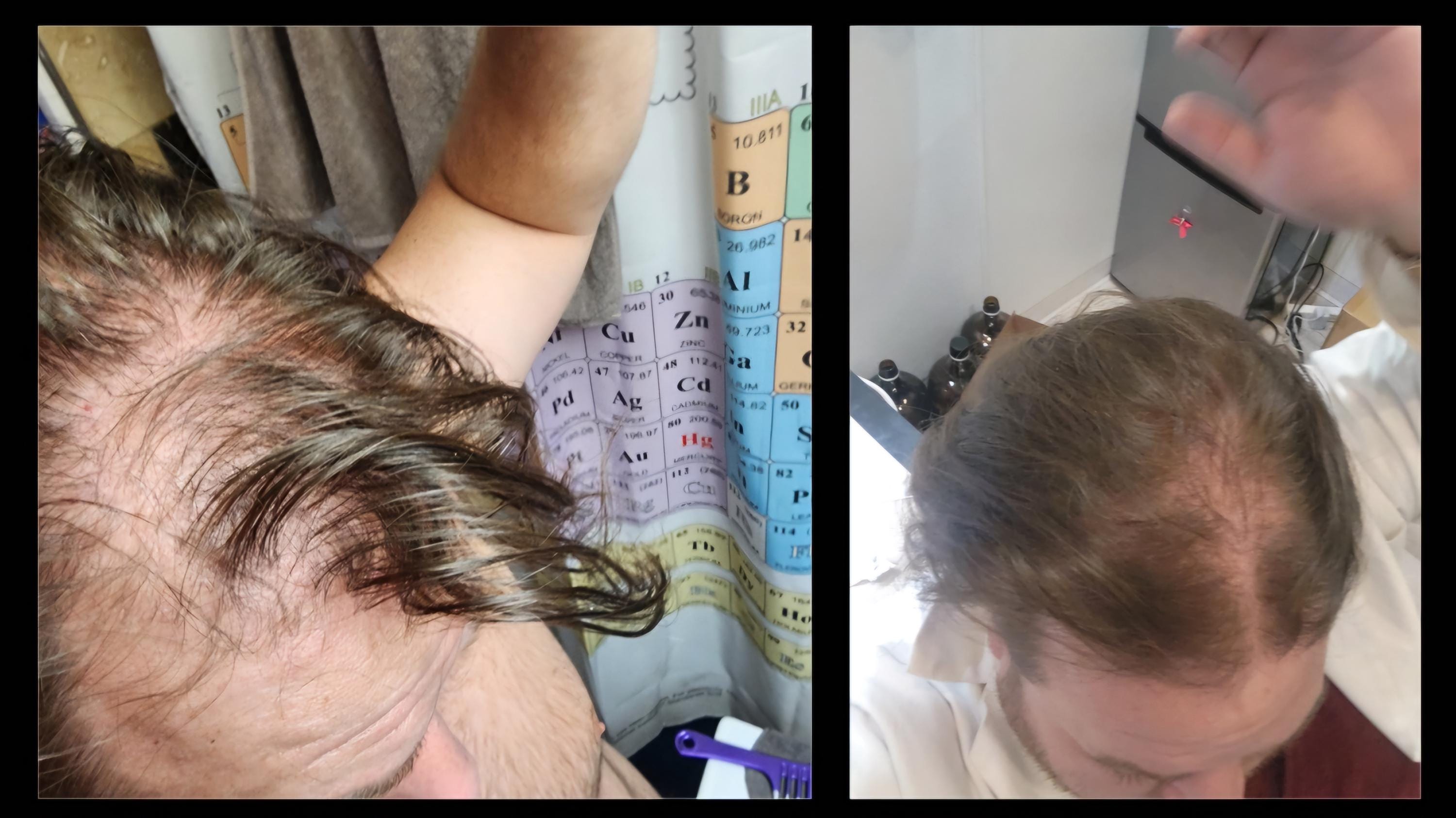 Samson's Apothecary Concentrated 1% Deoxyribose (2ddr) Hair Regrowth ...