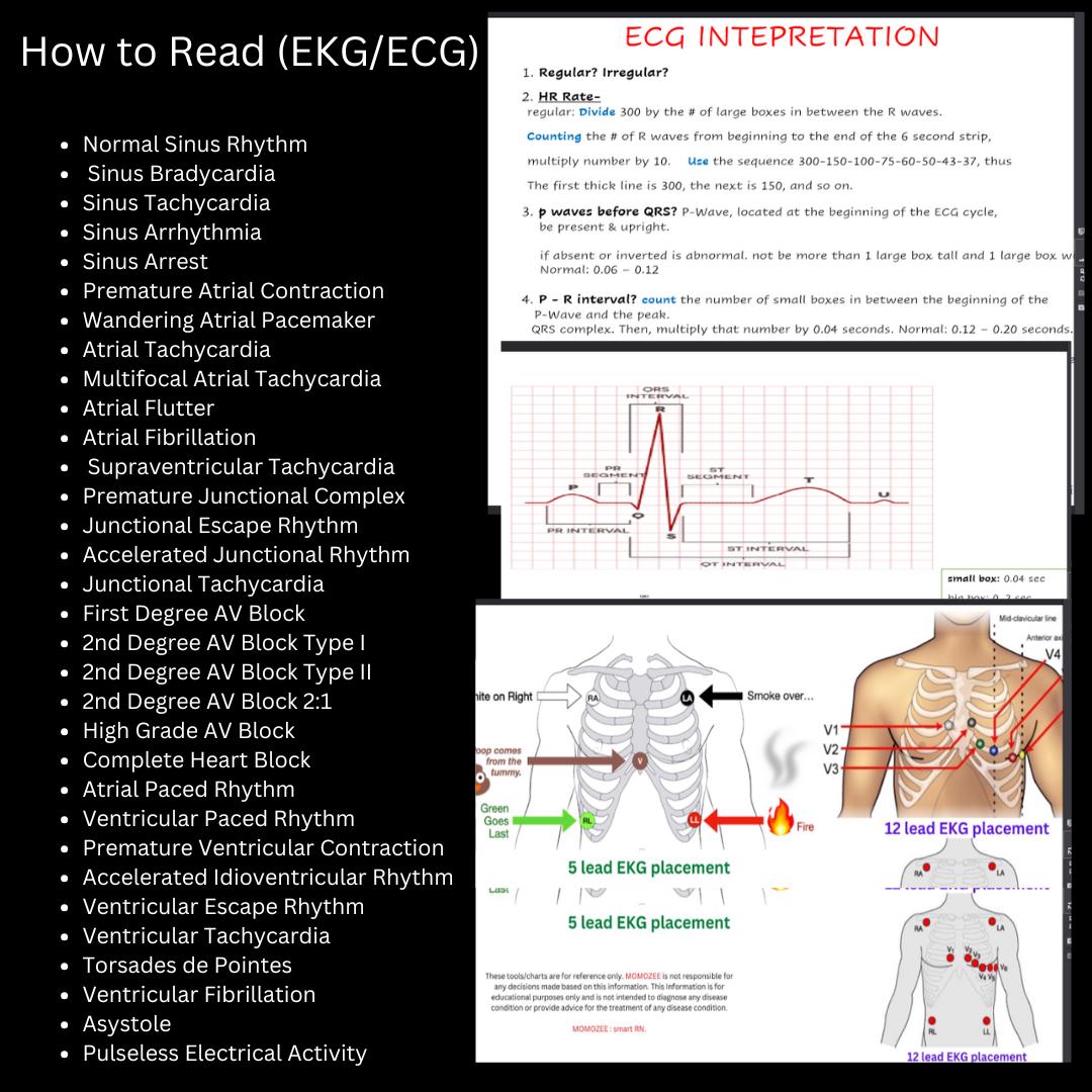 EKG Study Guide for Nursing Students BLS/ACLS Rhythms, Interventions ...