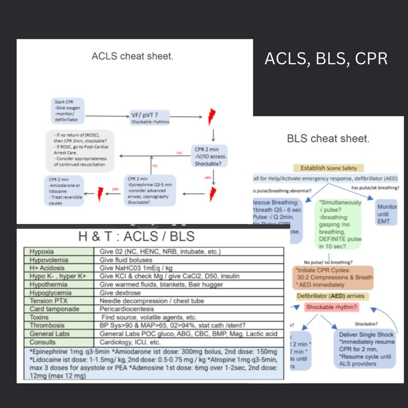 EKG Study Guide for Nursing Students BLS/ACLS Rhythms, Interventions ...
