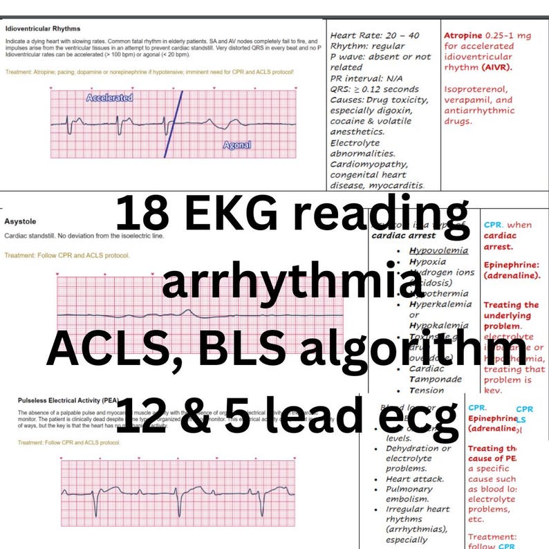 EKG Study Guide for Nursing Students BLS/ACLS Rhythms, Interventions ...