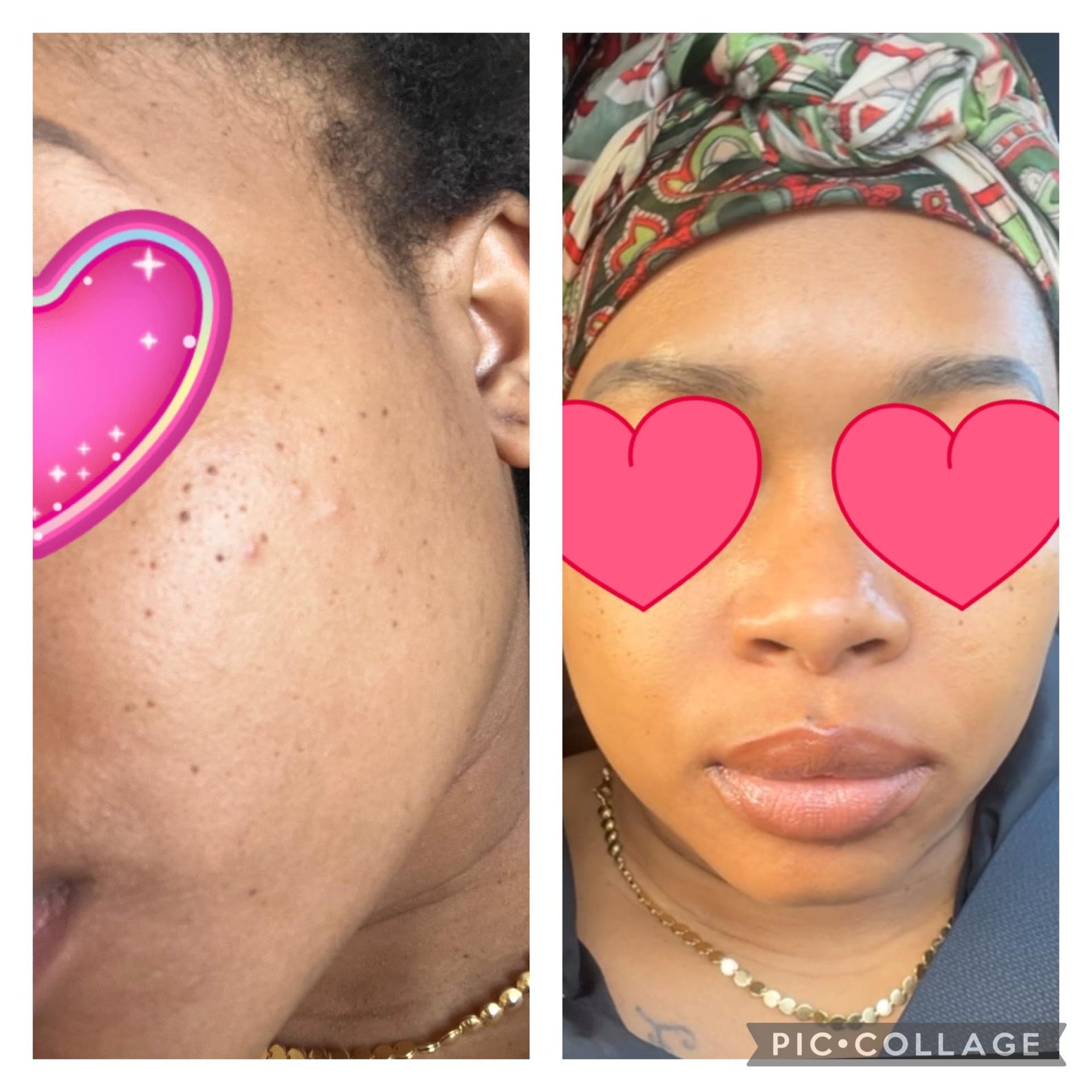 Tumeric Skincare Bundle - Etsy