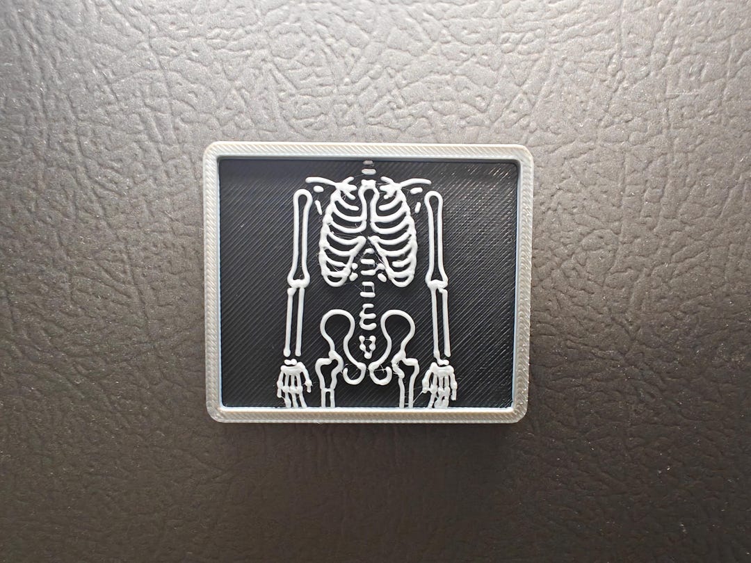 X-ray Magnet Gift Rad Tech Healthcare Decor Fridge Magnet Radiology ...
