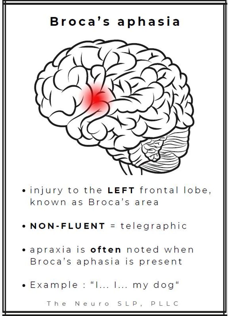 Aphasia Study Guide - Etsy