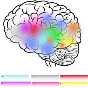 Aphasia Study Guide - Etsy