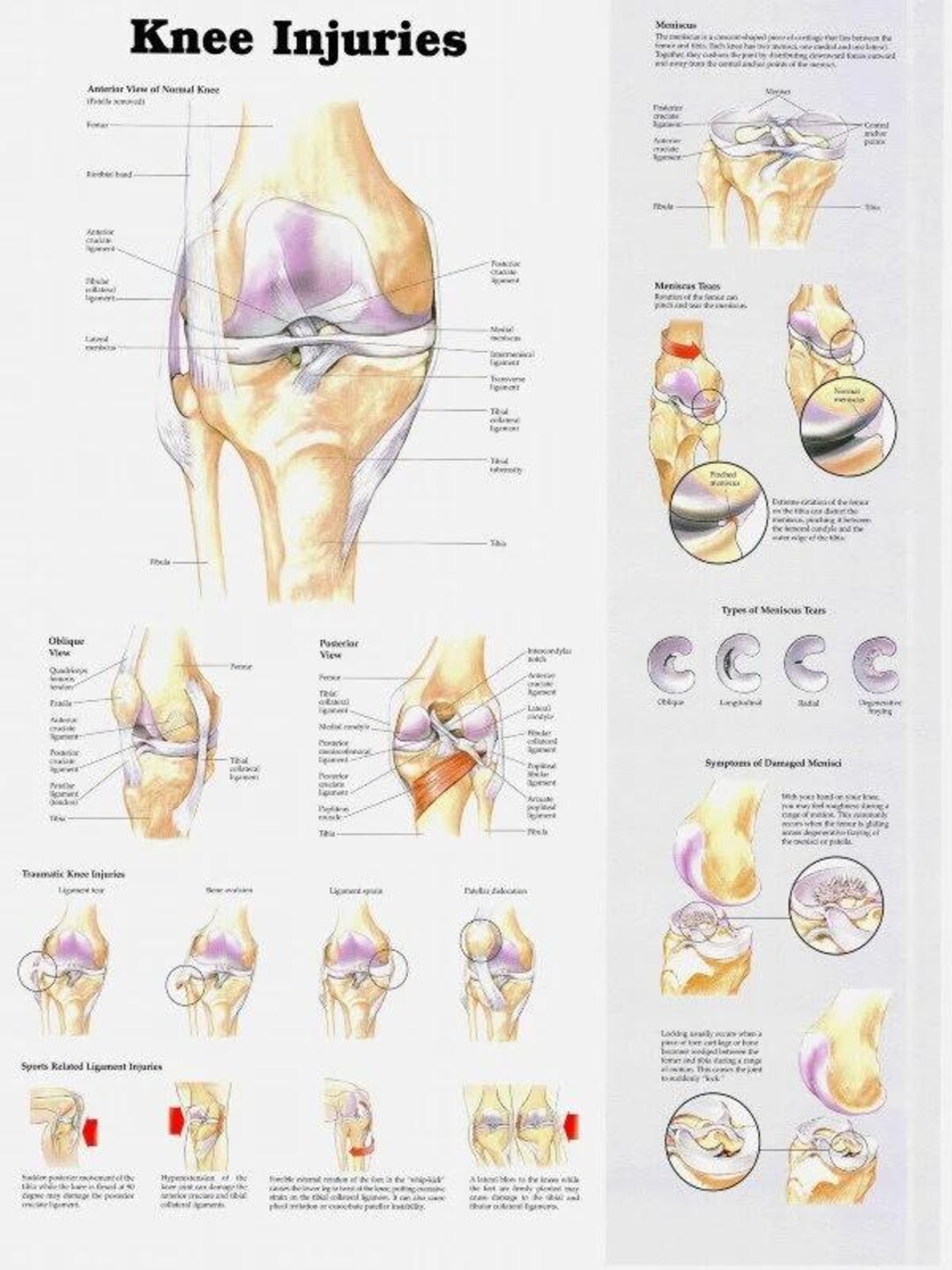 Knee Injuries System Wall Chart Poster Print Anatomical Human Body ...