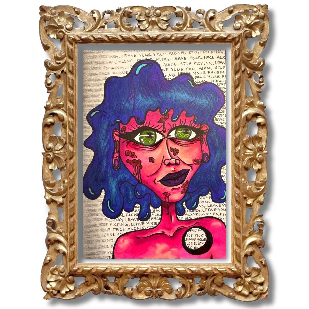 Stop Picking Leave Your Face Alone Art Print OCD Girl Dermatillomania ...