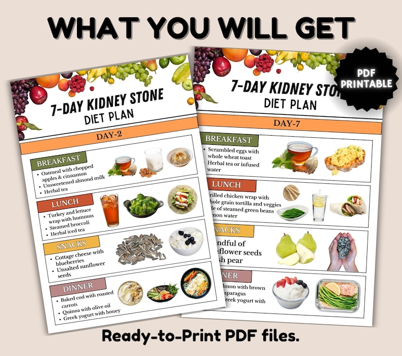 Kidney Stone 7-day Diet Plan Printable, Low Oxalate Foods, Renal Diet ...
