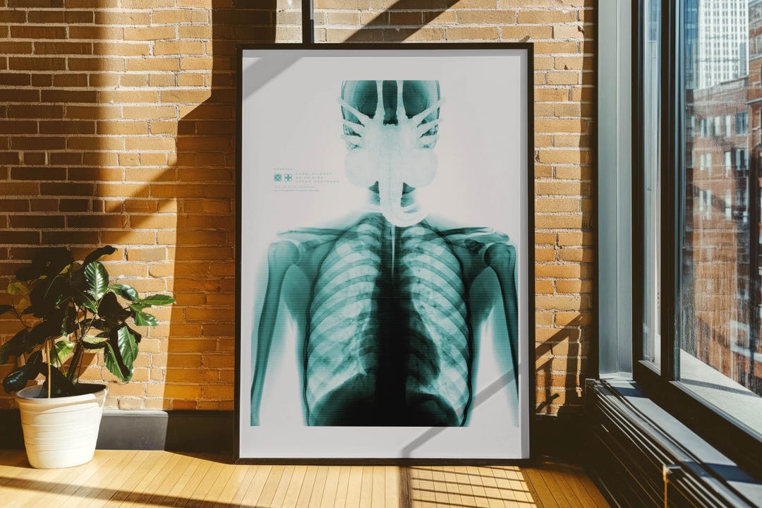 Alien Movie Rare Poster, DIGITAL, Facehugger Medscan, Classic Cinema ...