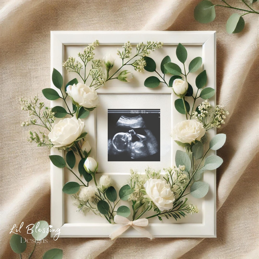 Minimalist Framed Ultrasound Pregnancy Announcement Digital Instagram ...