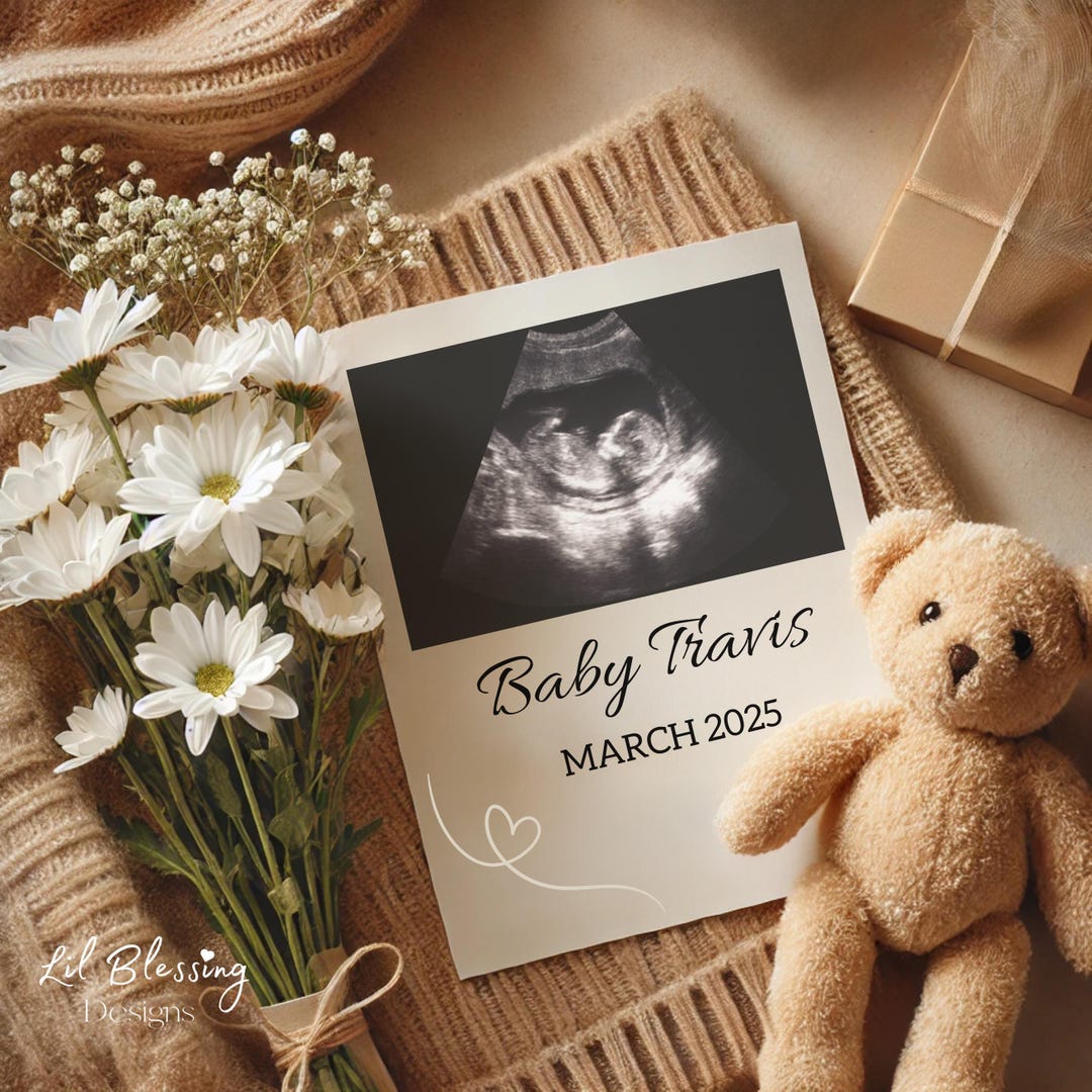 Gender Neutral Pregnancy Announcement | Ultrasound Social Media ...