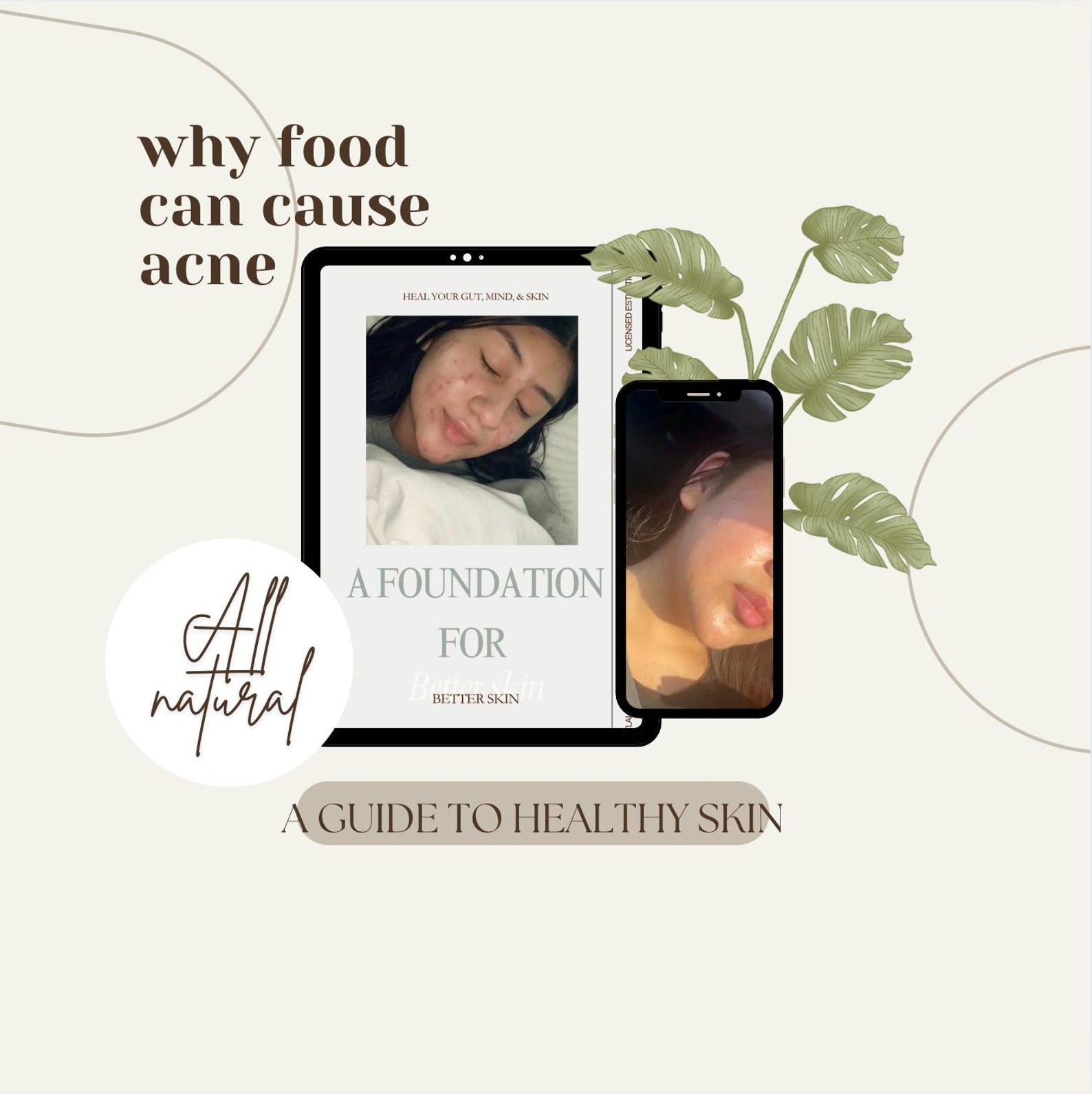 A Foundation for Better Skin. Heal Your Acne Naturally. Learn How Food ...