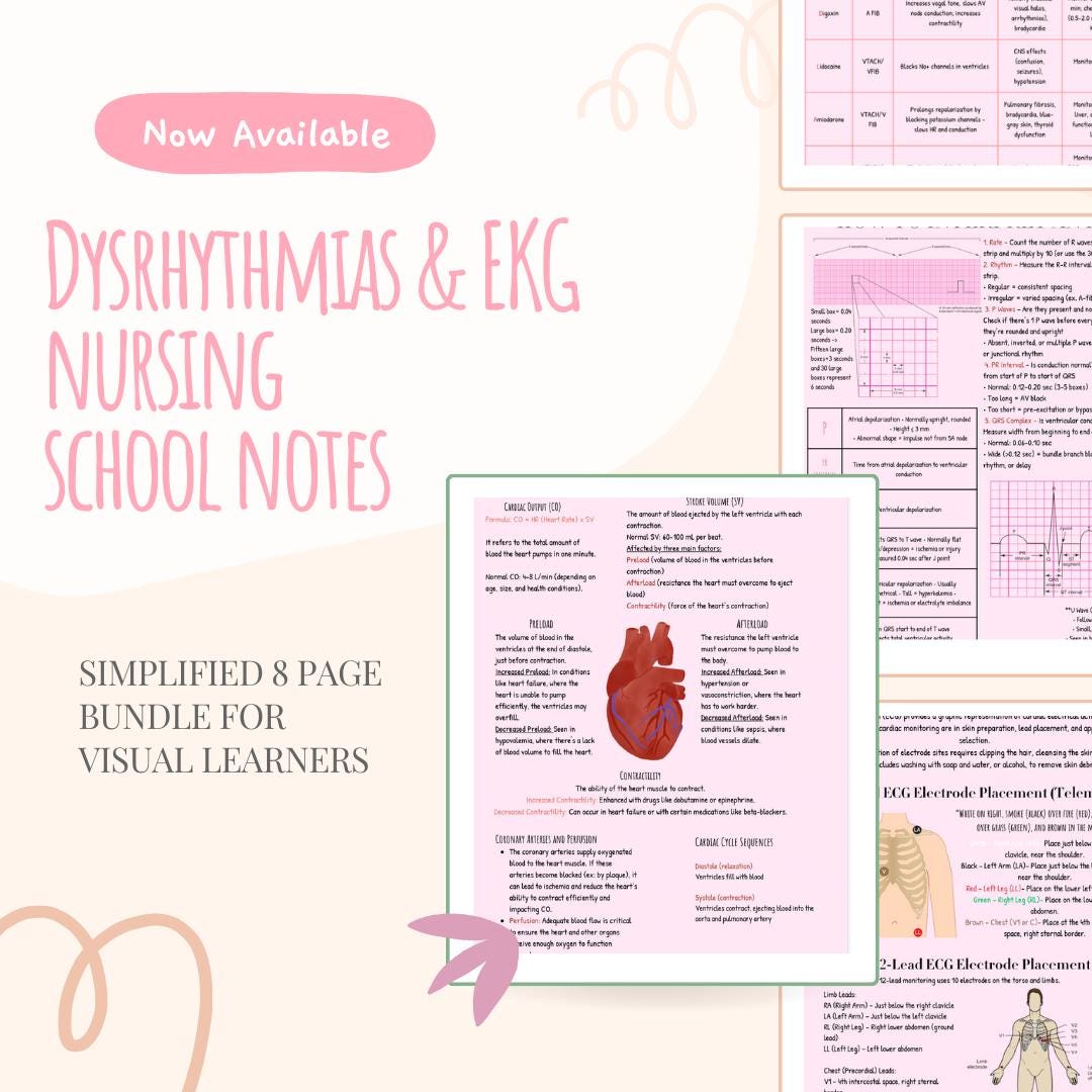 Dysrhythmia Study Guide | 8-page Printable Nursing Resource - Etsy