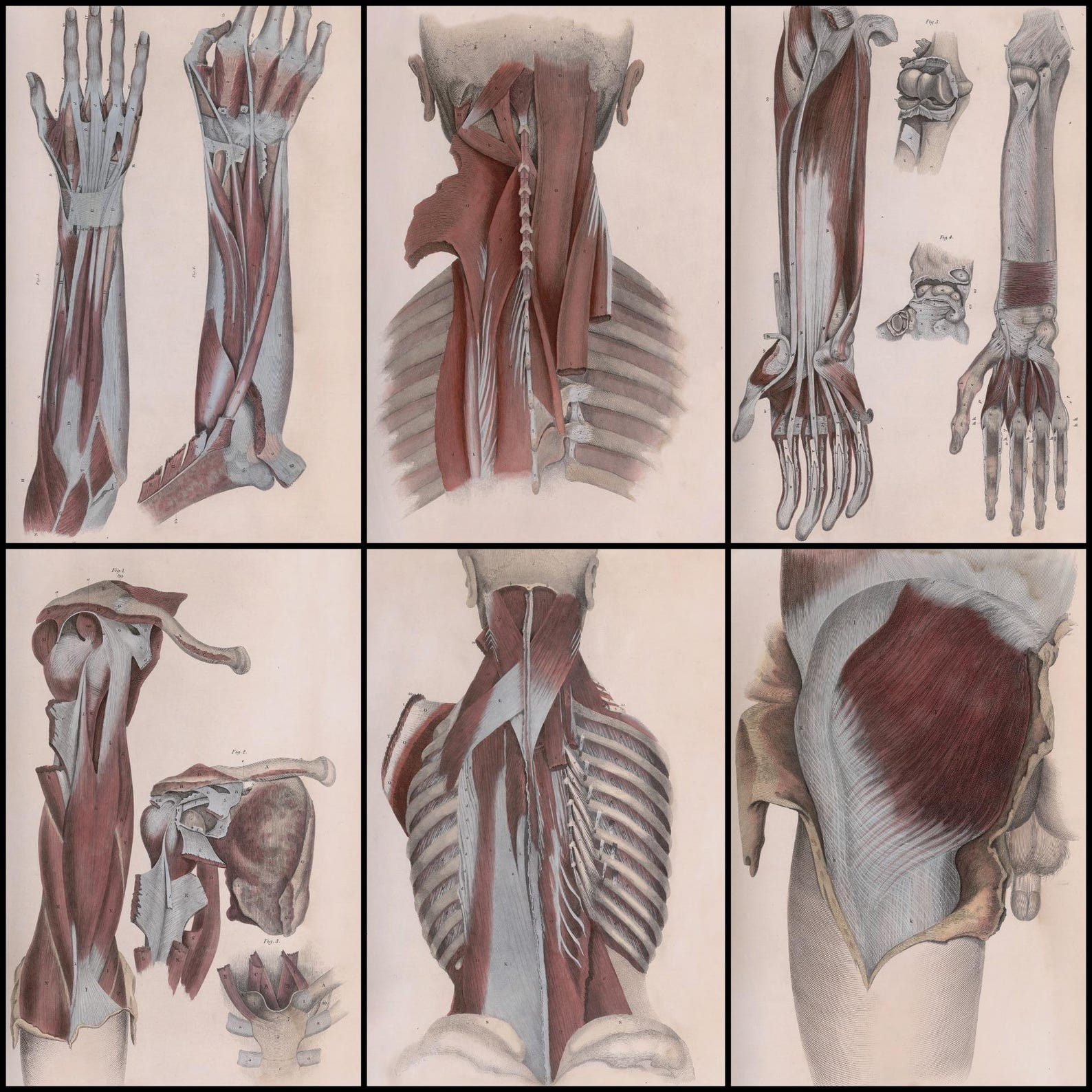 100+ Vintage Anatomy Plates by John Lizars / High-res Tiffs 300 DPI ...
