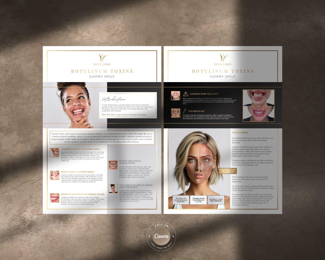 Botox Lesson Gummy Smile Cheat Sheets, Reference Guide, Learning ...